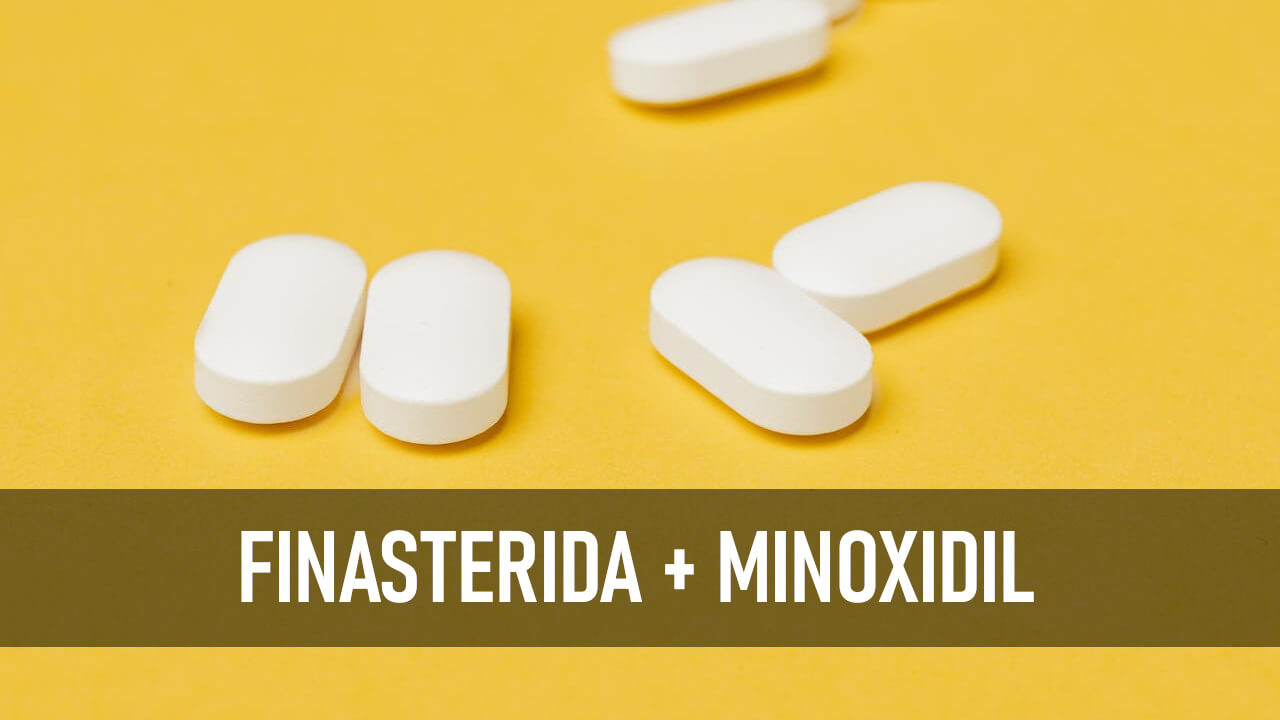 Posso combinar Finasterida e Minoxidil no tratamento de queda de cabelo ...