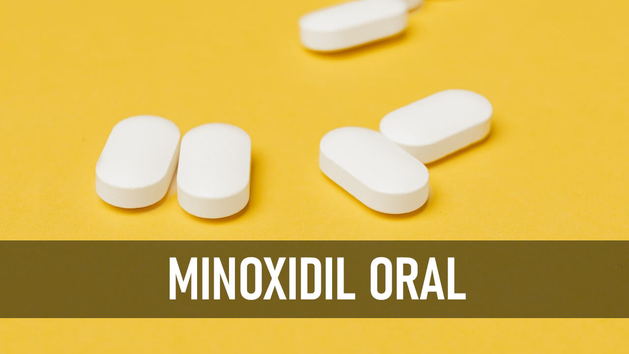 Minoxidil Oral: entenda tudo sobre a versão em comprimidos do Minoxidil ...